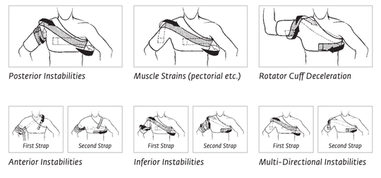 DonJoy® Sully Shoulder Stabilizer Brace – My Cold Therapy